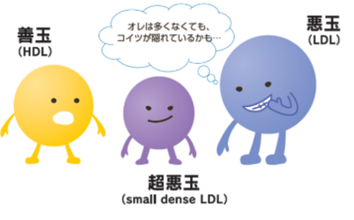 small dense LDLは脂質管理の要、中性脂肪を下げる意義について | 用賀きくち内科 肝臓・内視鏡クリニック